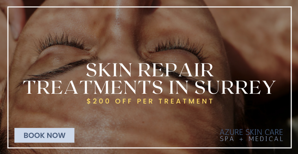 Skin Repair Treatments in Surrey: NanoFractional Radio Frequency ...